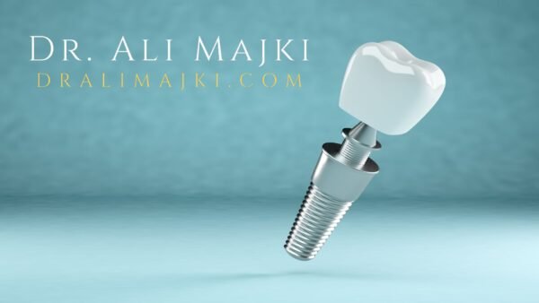 Understanding Dental Implants: A Long-Term Solution for Missing Teeth - Dr. Ali Majki